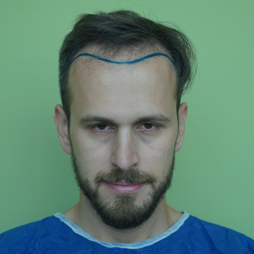 Results – DHI Clinic Turkey